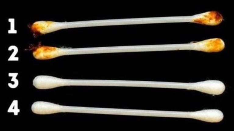 Nos oreilles révèlent notre vrai état de santé selon la couleur du ...