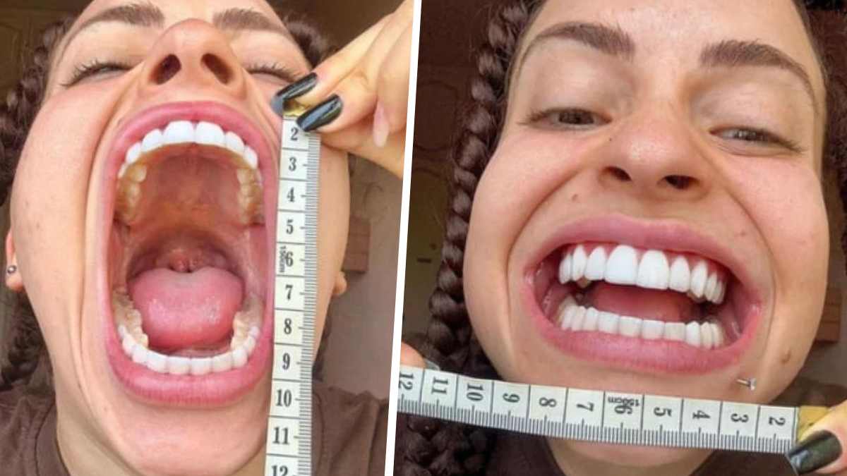 Cette jeune femme de 22 ans a la plus grande bouche du monde et elle ...