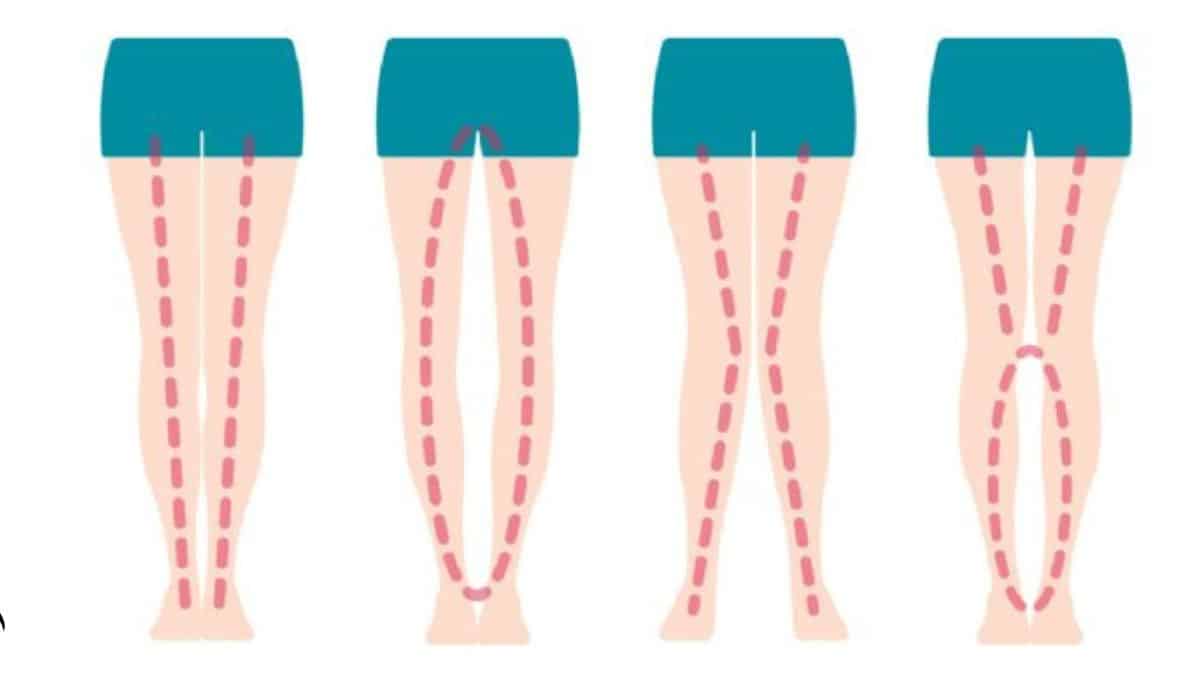 Test de personnalité: la forme de vos jambes révèle un gros secret